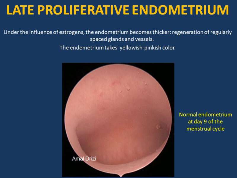 Description of the Endometrium at the different phases of the Menstrual ...