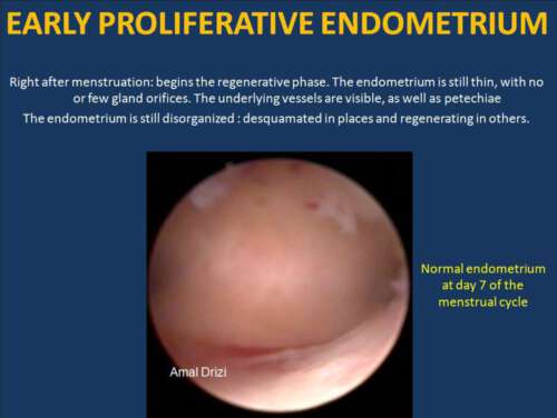 Description of the Endometrium at the different phases of the Menstrual ...
