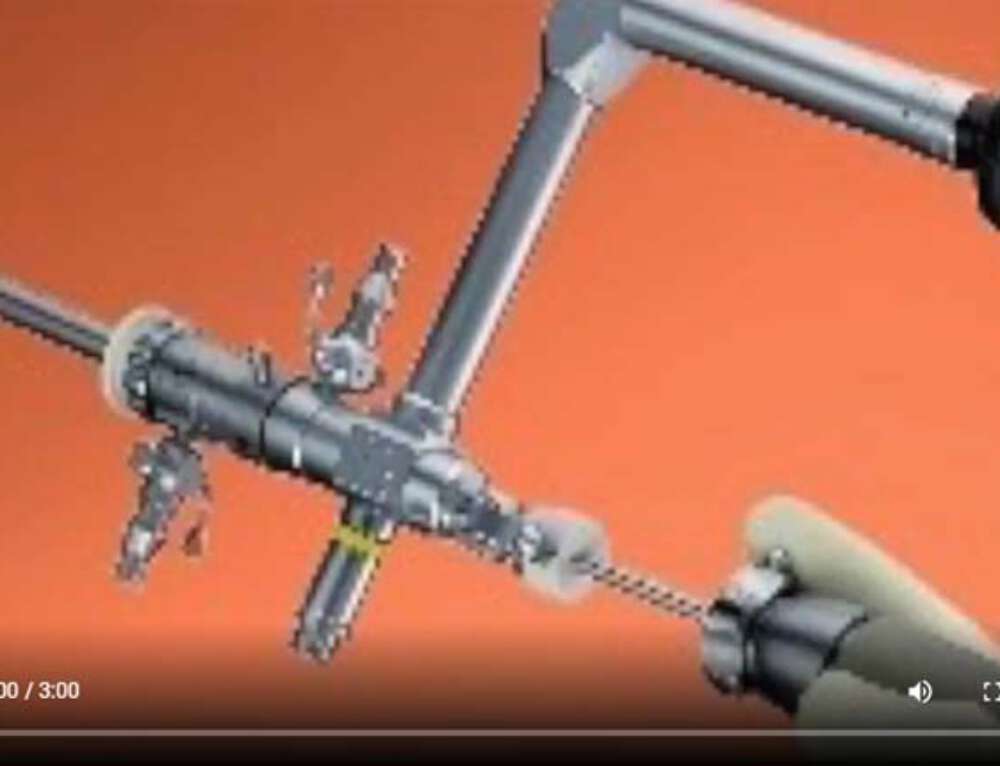 vNOTES (transvaginal natural orifice transluminal endoscopic surgery ...