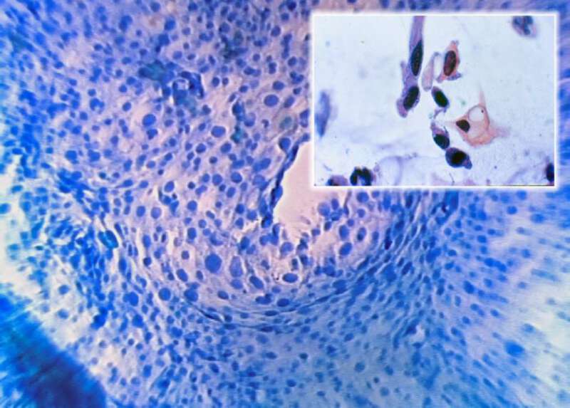 Diagnostic hysteroscopy: vagina and cervix. Micro-colpo-hysteroscopy – ISGE