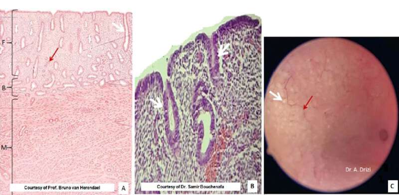 Diagnostische Hysteroskopie: eine atlasartige Übersicht über das ...