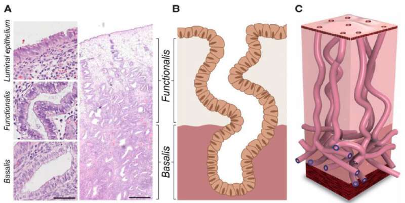 Structure and Appearance of Endometrial Blood Vessels at Hysteroscopy ...