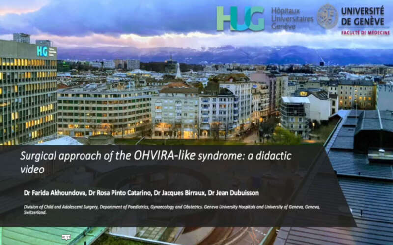 Obstructed hemivagina and ipsilateral renal anomaly (OHVIRA) syndrome ...